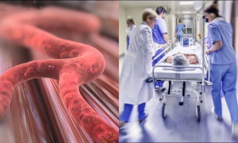 Leiomiosarcoma Un Cáncer Raro y Desafiante que Requiere Atención ...